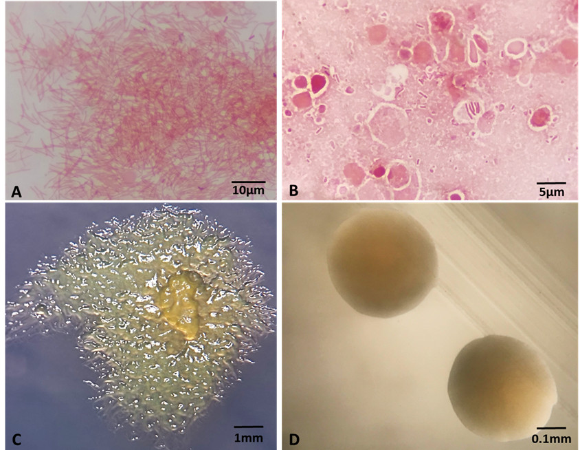 Nghiên cứu bệnh đồng nhiễm do vi khuẩn Edwardsiella ictaluri và ...